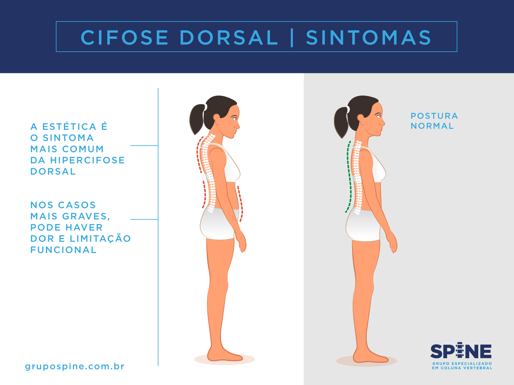 Curvaturas Fisiológicas Da Coluna Vertebral - LIBRAIN